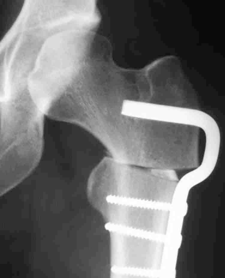 Hüftdysplasie - MVZ Wiesbaden